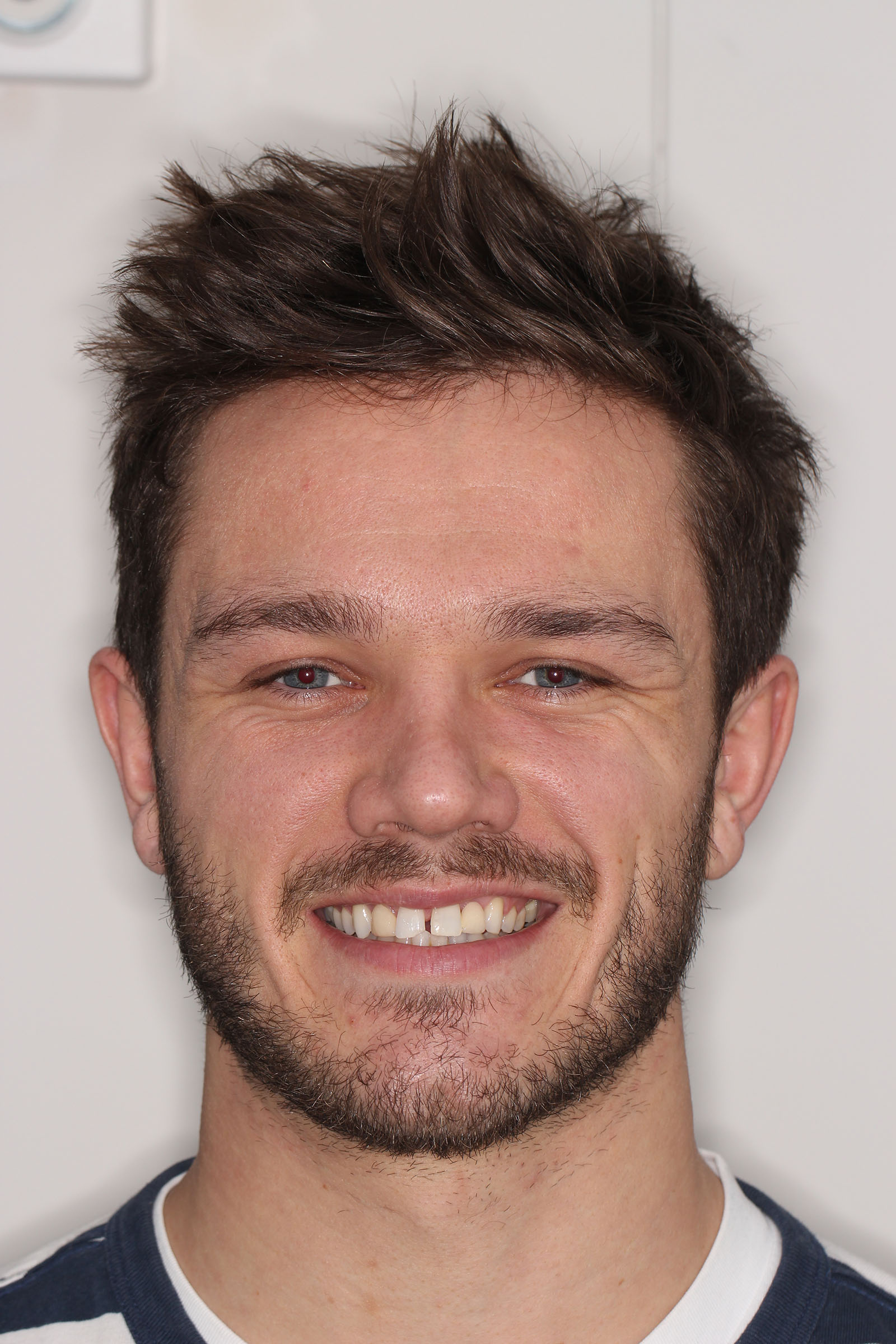 Invisalign, Composite Bonding and implants at Wadebridge Dental ...